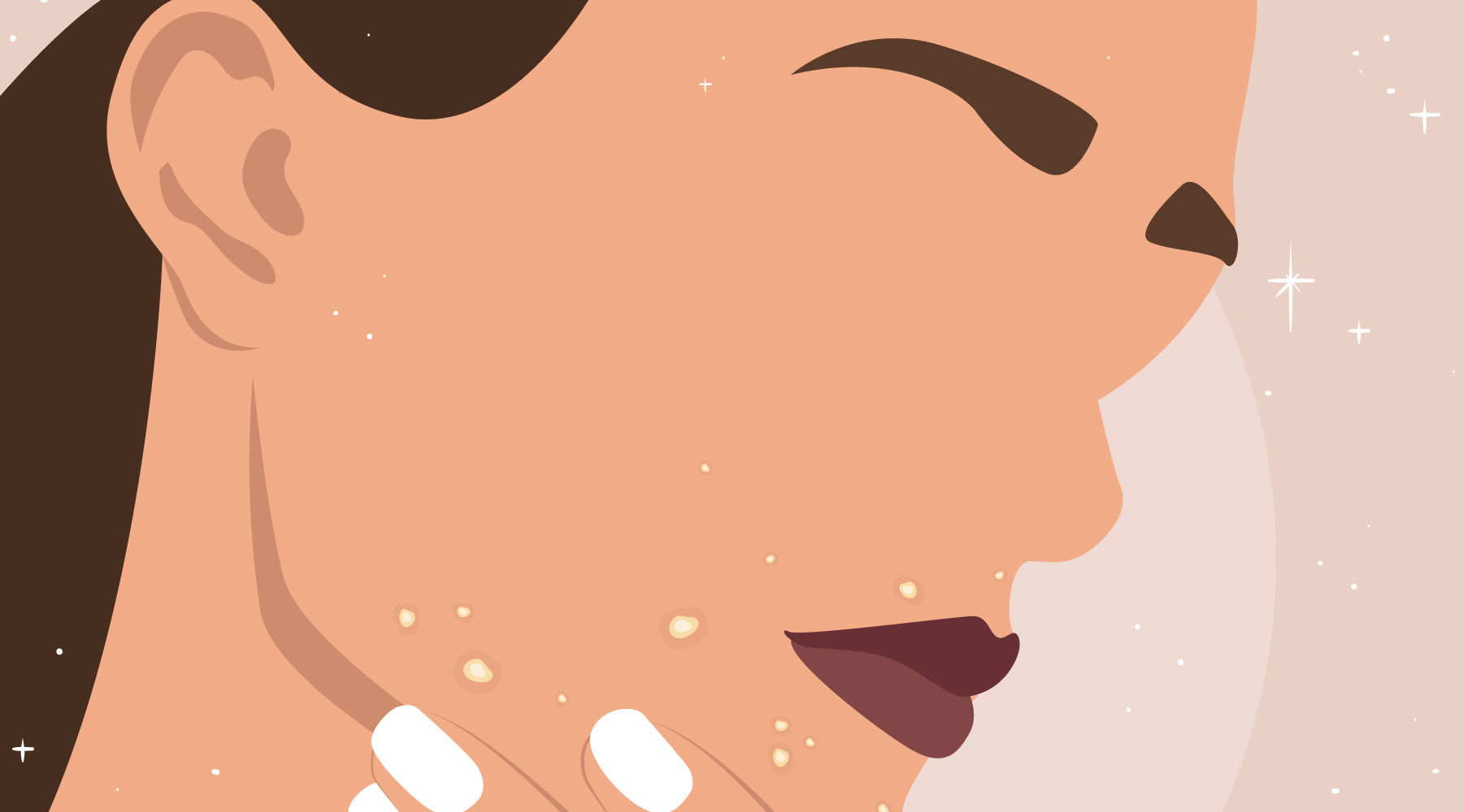 Top Hormonal Acne Skincare & Serum Tips – Beauty Affairs AU
