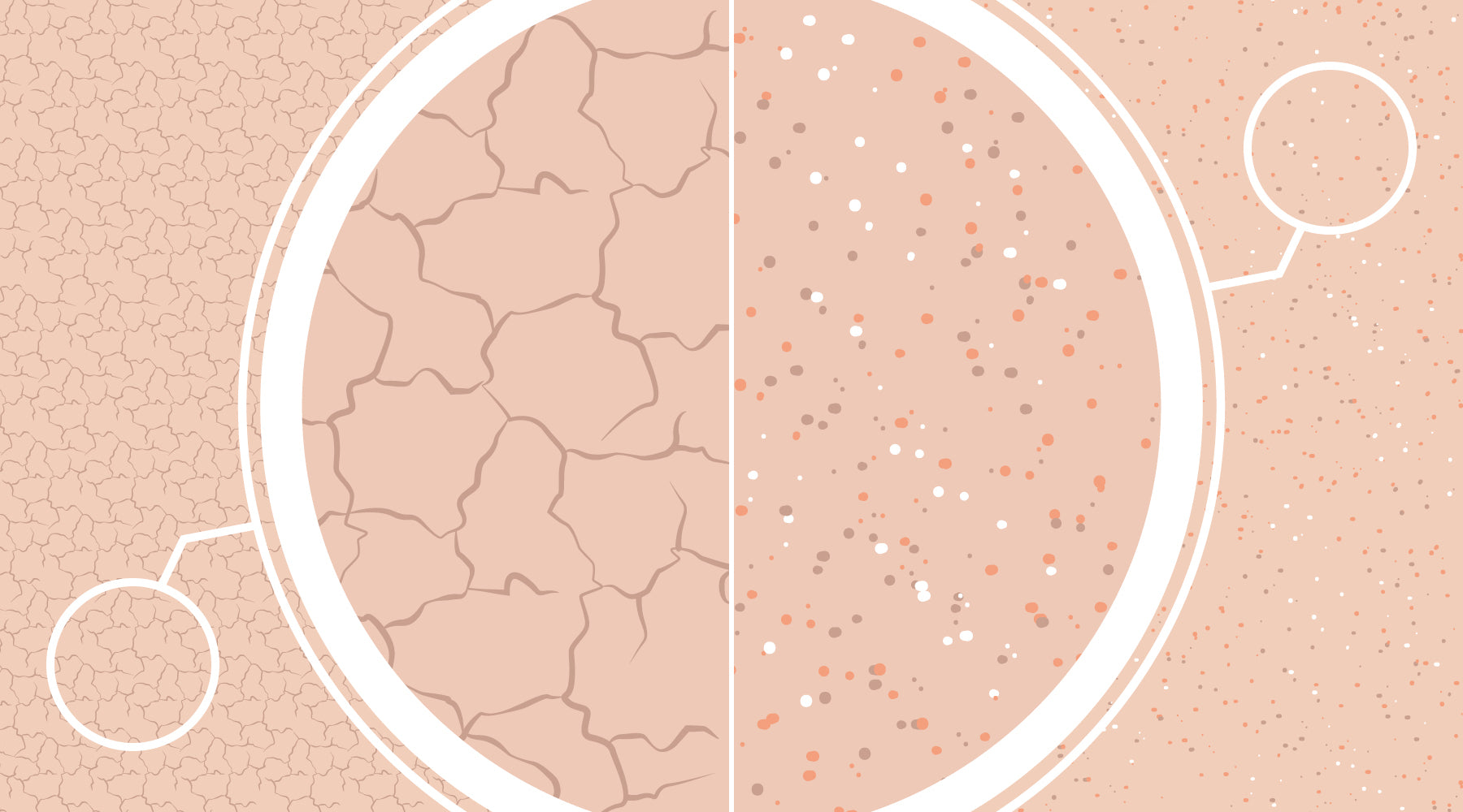 Dry vs Dehydrated Skin: Key Differences – Beauty Affairs AU